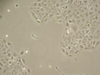 UM-SCC-47 HPV-16 Positive Squamous Carcinoma Cell Line | SCC071